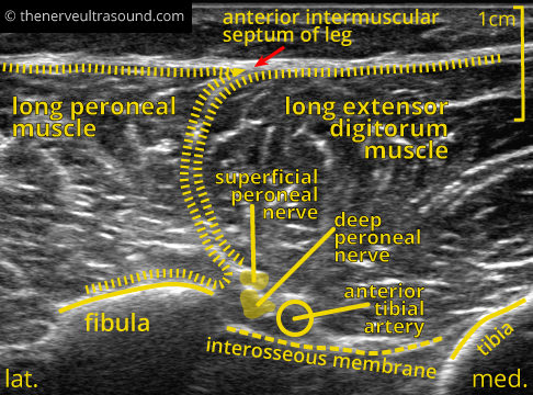 Standard sections peroneal nerves – The Nerve Ultrasound